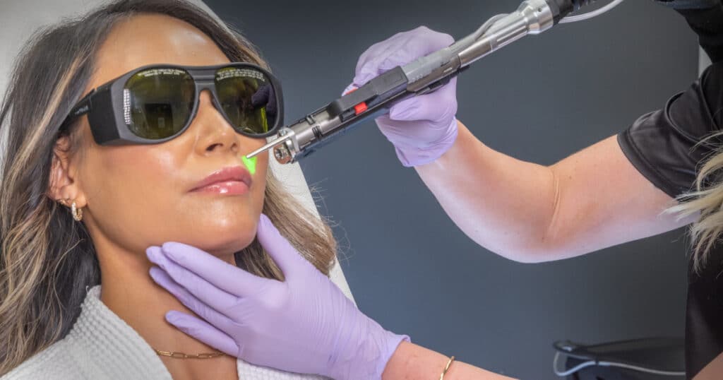 Guide to Facial, Ears & Neck Laser Hair Removal in Atlanta - WIFH